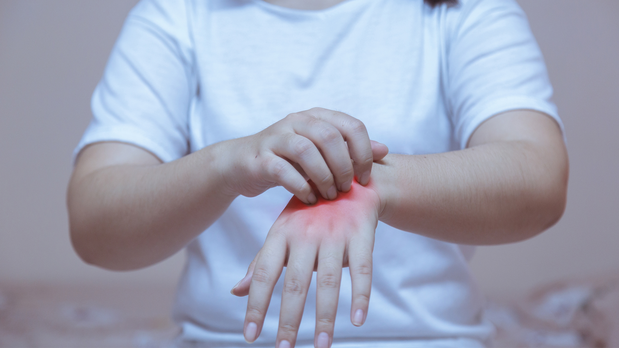 Beyond Skin Deep: Impacts of Psoriatic Arthritis - Rheumatology Academy